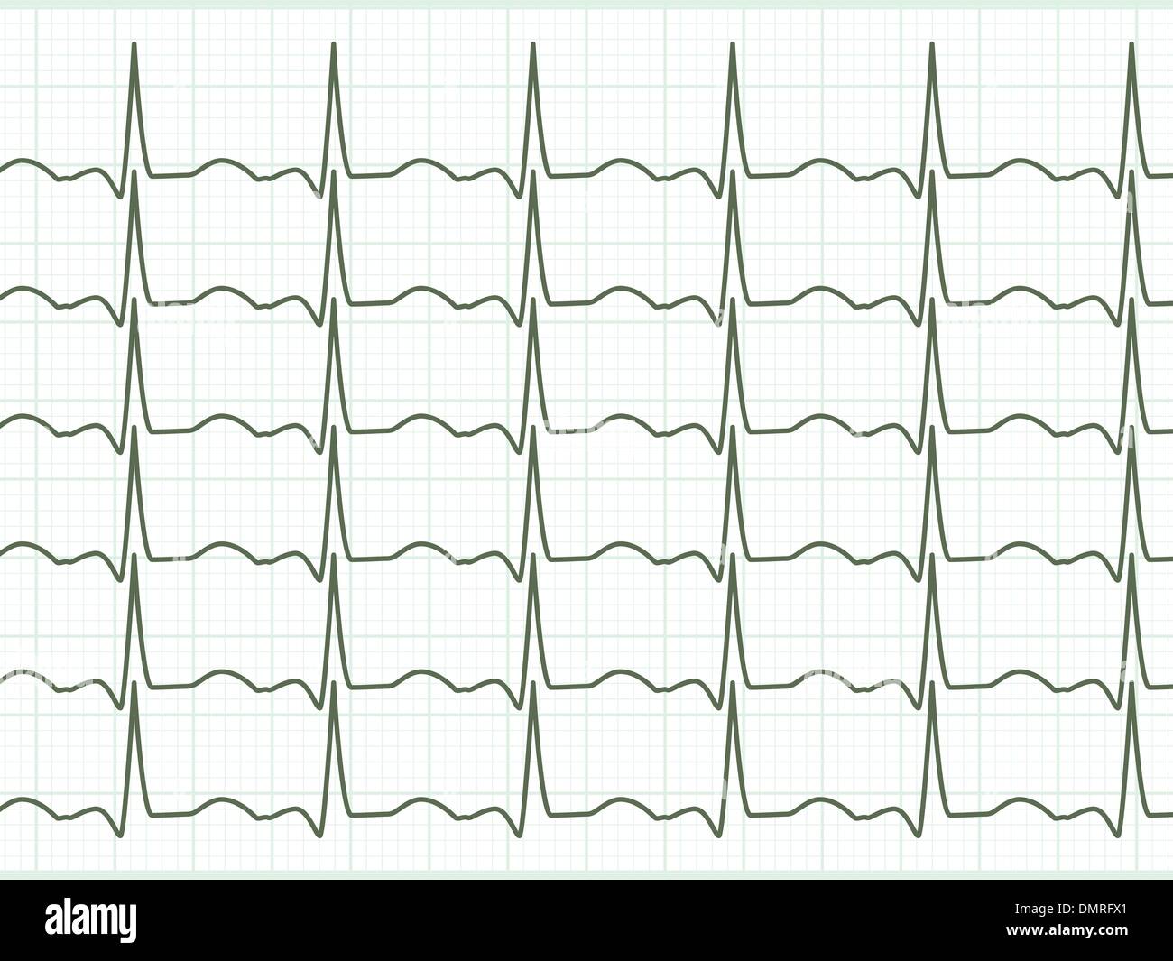 Heart cardiogram hi-res stock photography and images - Alamy