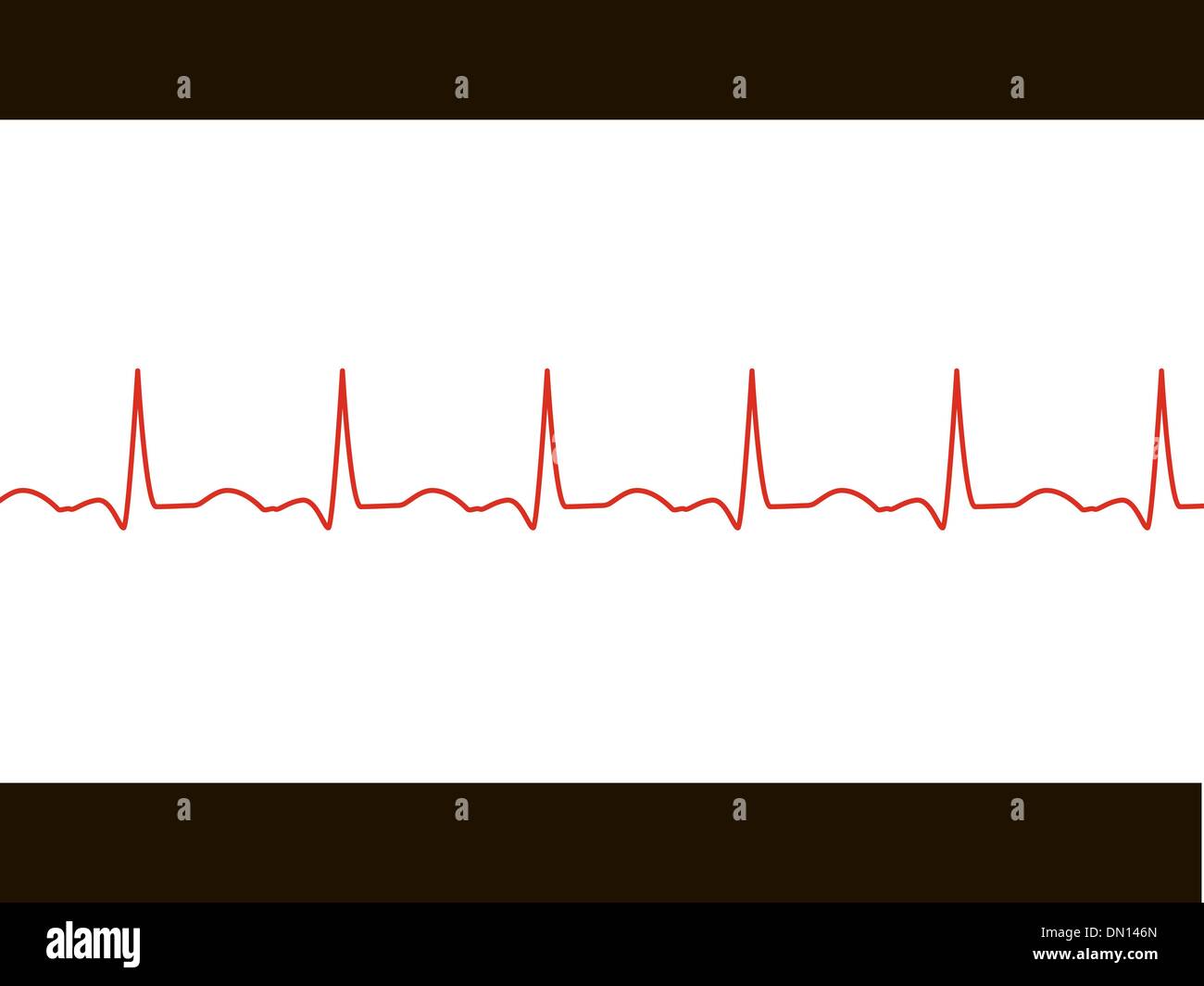 Ecg normal heart beat Stock Vector Images - Alamy