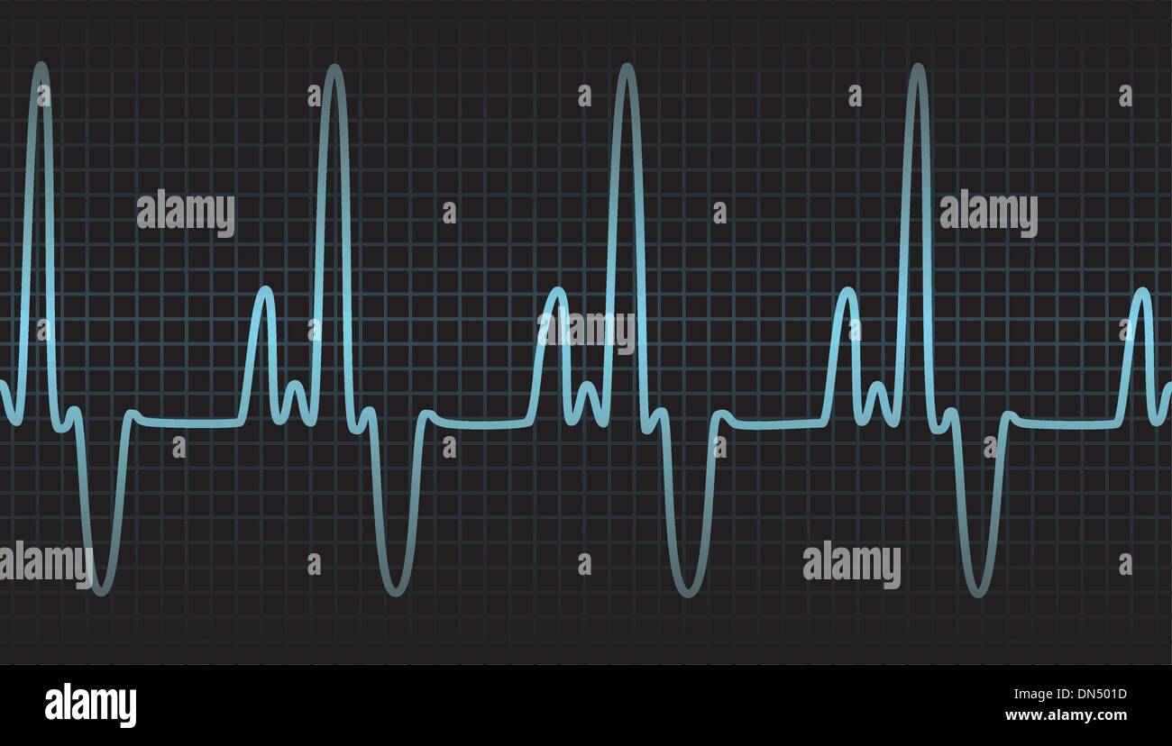 Electrocardiogram hi-res stock photography and images - Alamy