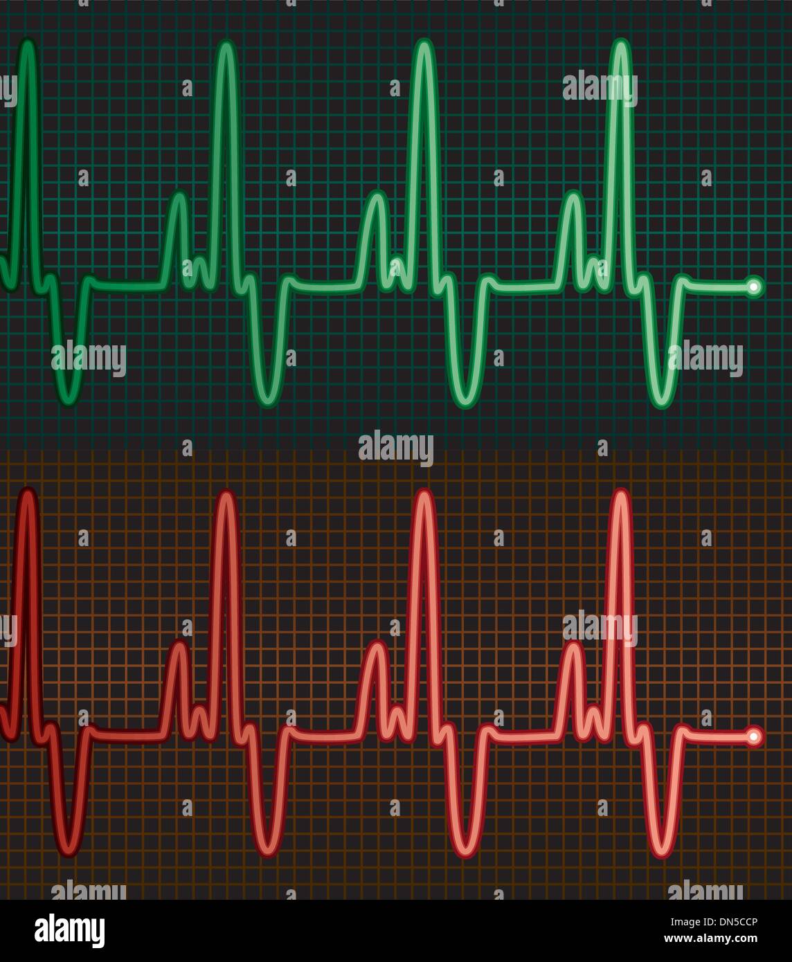 electrocardiograms of the human heart Stock Vector Image & Art - Alamy