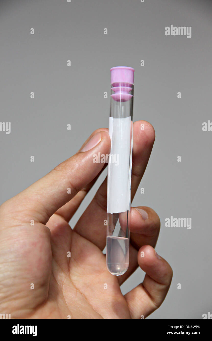The Picture of Stool test Tubes in hand Stock Photo - Alamy