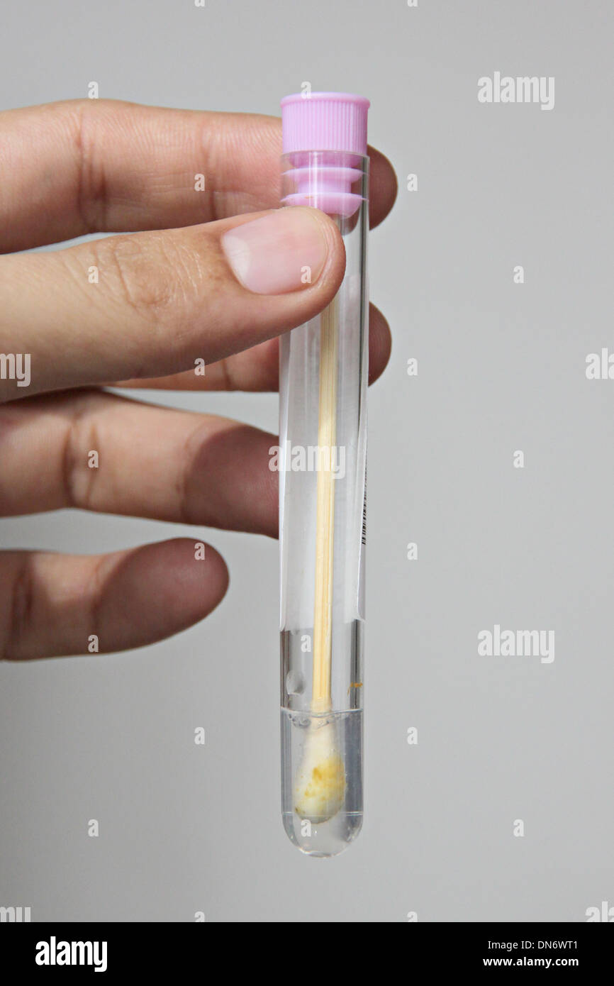 Stool Samples High Resolution Stock Photography and Images - Alamy