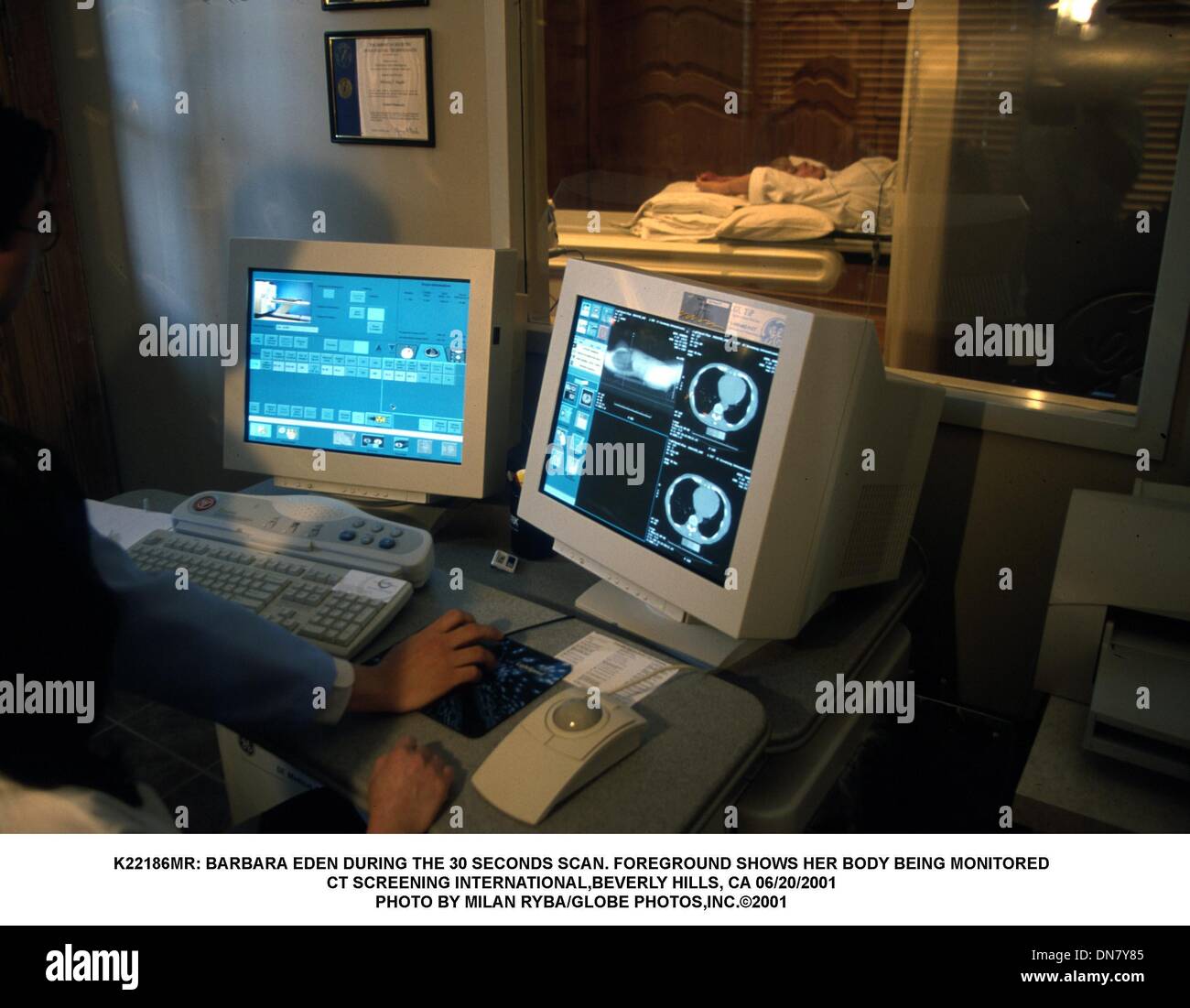 June 20, 2001 - K22186MR: BARBARA EDEN DURING THE 30 SECONDS SCAN ...