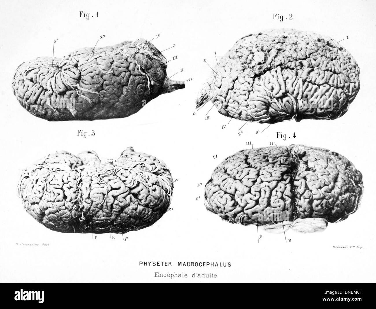 EncCA9phale adulte appears to be a typo or misspelling. Unable to ...
