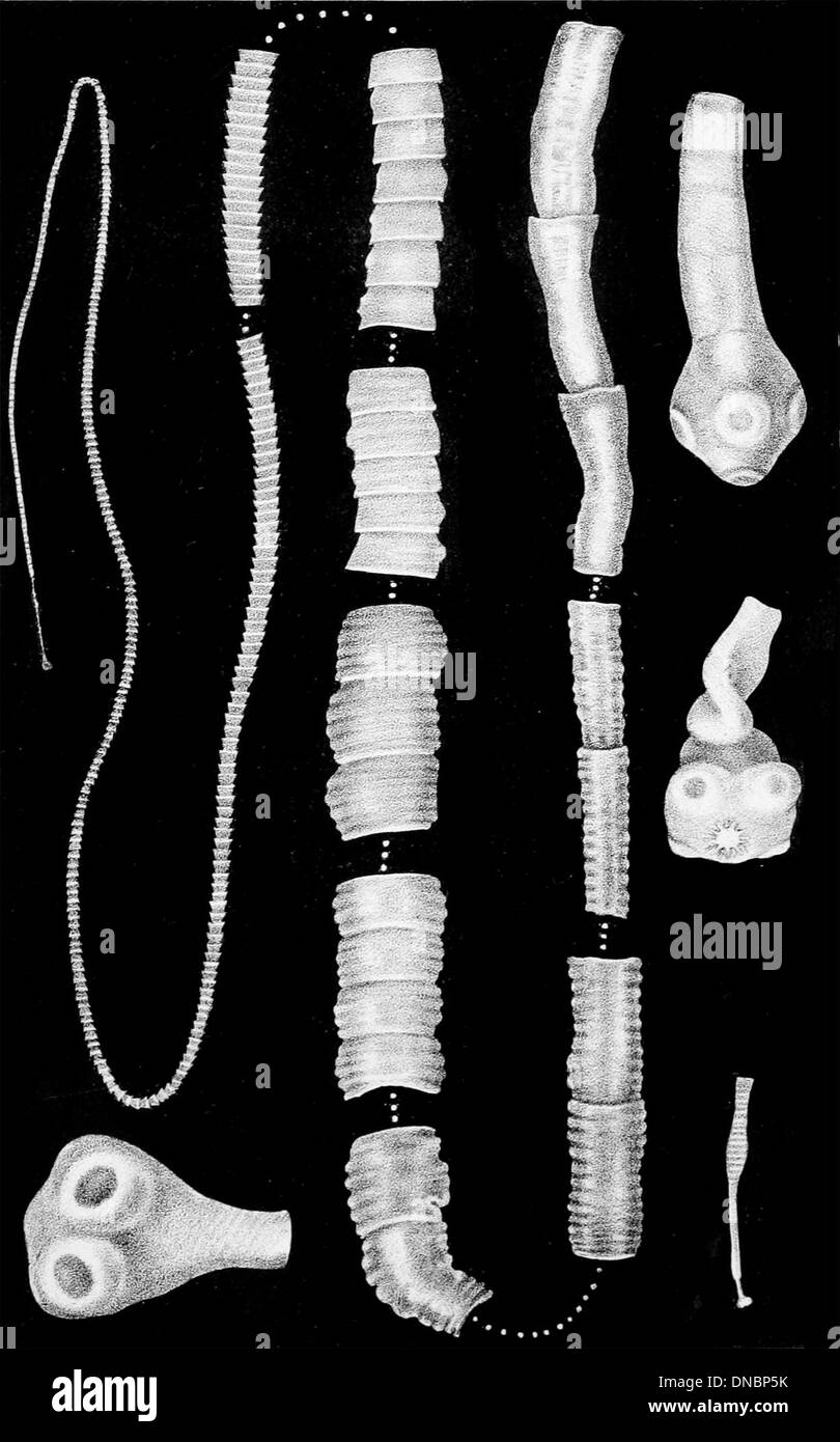 Pork tapeworm hi-res stock photography and images - Alamy