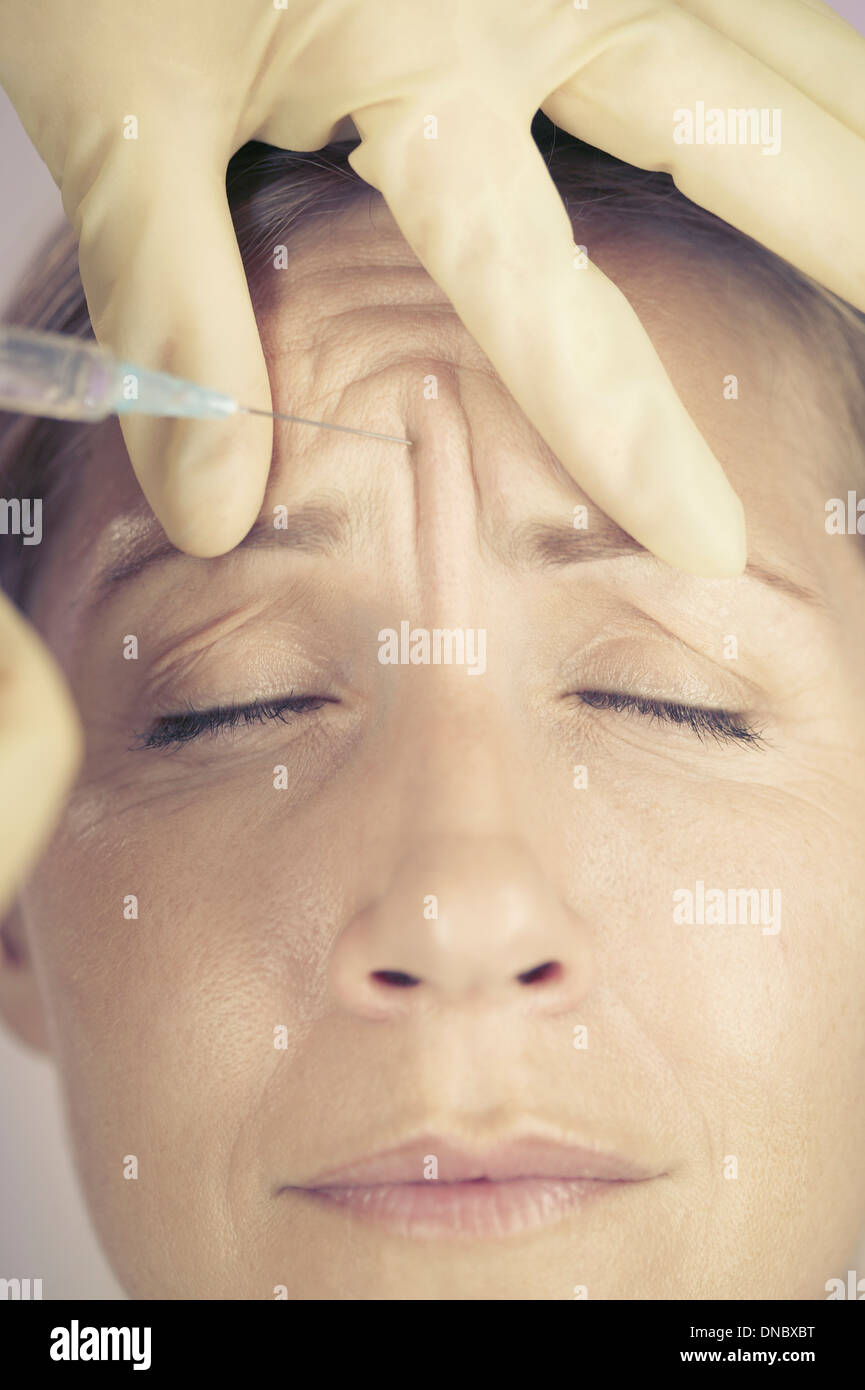 A middle aged woman having a Botox injection in her forehead Stock ...