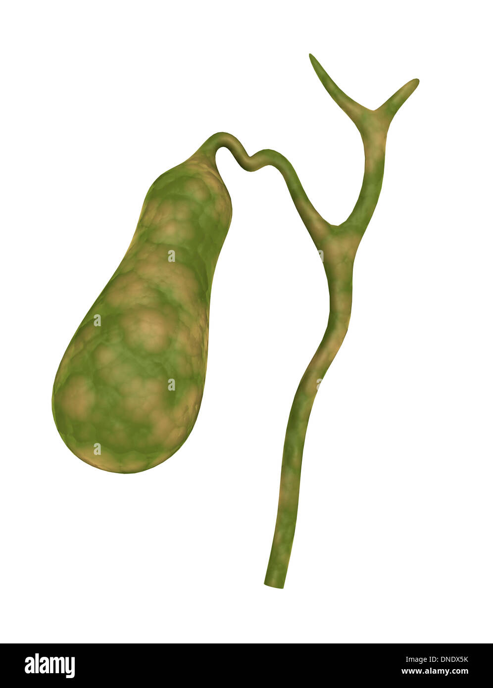 Cholecyst hi-res stock photography and images - Alamy