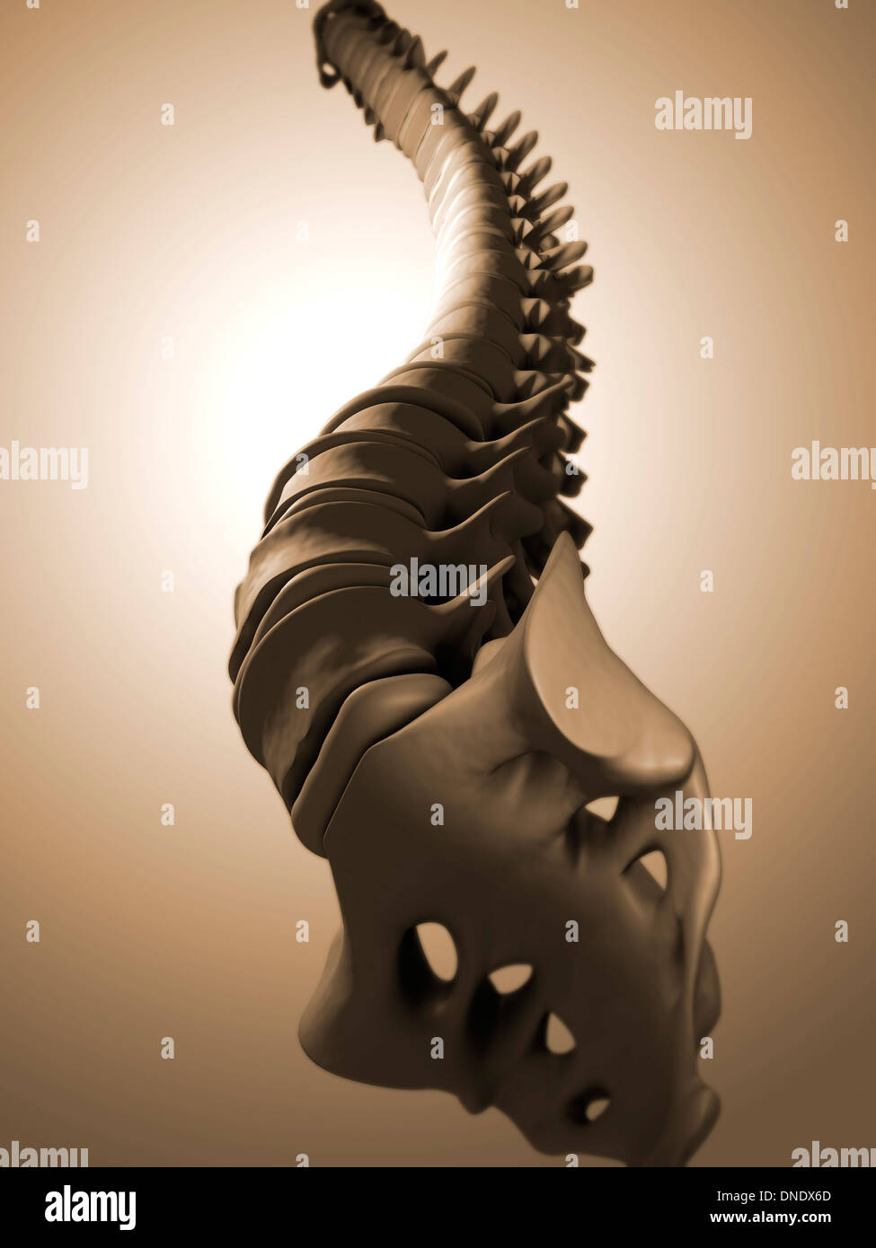 Curvature of the spine hi-res stock photography and images - Alamy