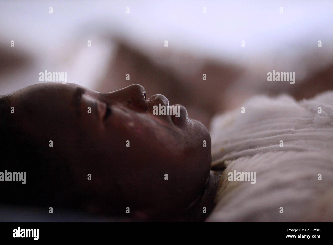 Dhaka, Bangladesh. 24th December 2013 -- Severely burned Afroza Begum ...