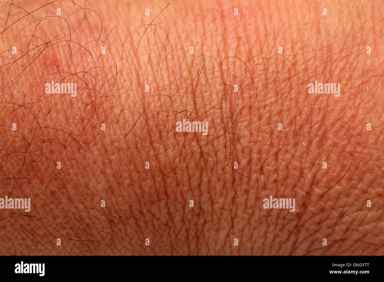 Skin close up Stock Photo - Alamy
