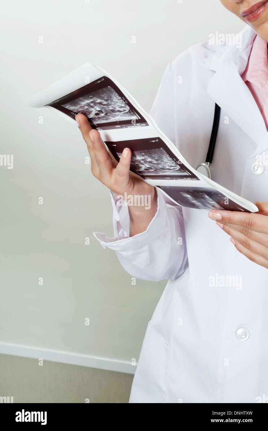 Radiologist Holding Ultrasound Print Stock Photo - Alamy