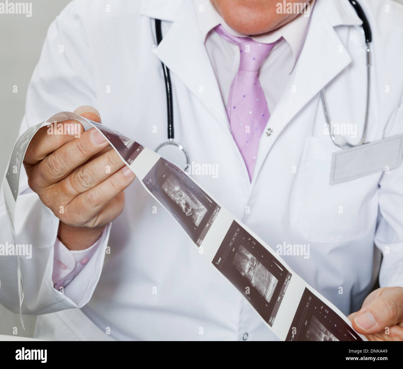 Radiologist Holding Ultrasound Print Stock Photo - Alamy