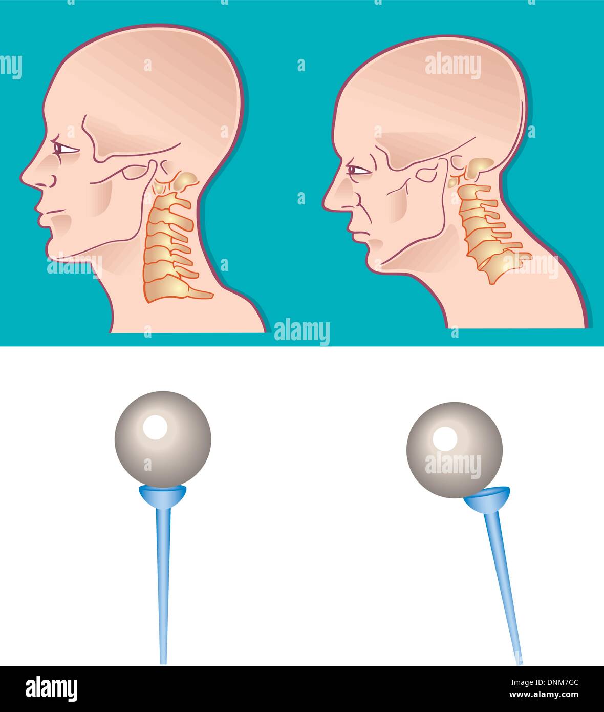 Illustration of neck spine cross section Stock Vector Image & Art - Alamy