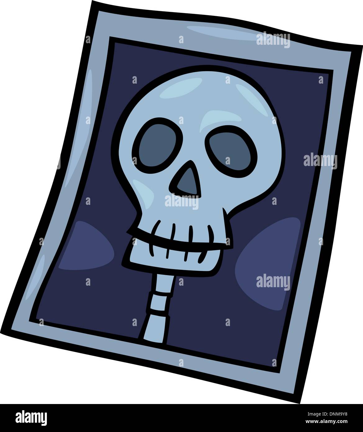 X Ray Skeleton Cartoon