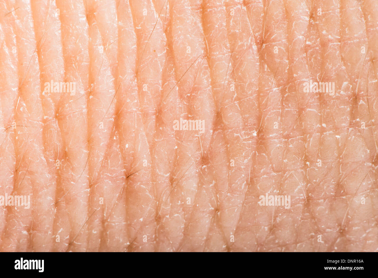 Close up human skin. Macro epidermis texture Stock Photo - Alamy