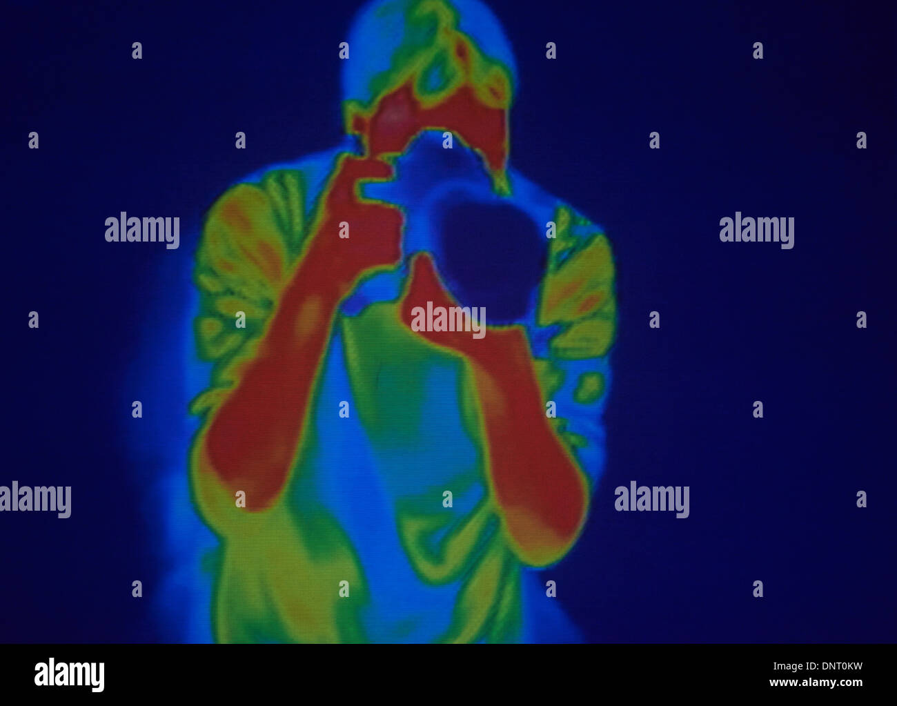 Thermogram hi-res stock photography and images - Alamy