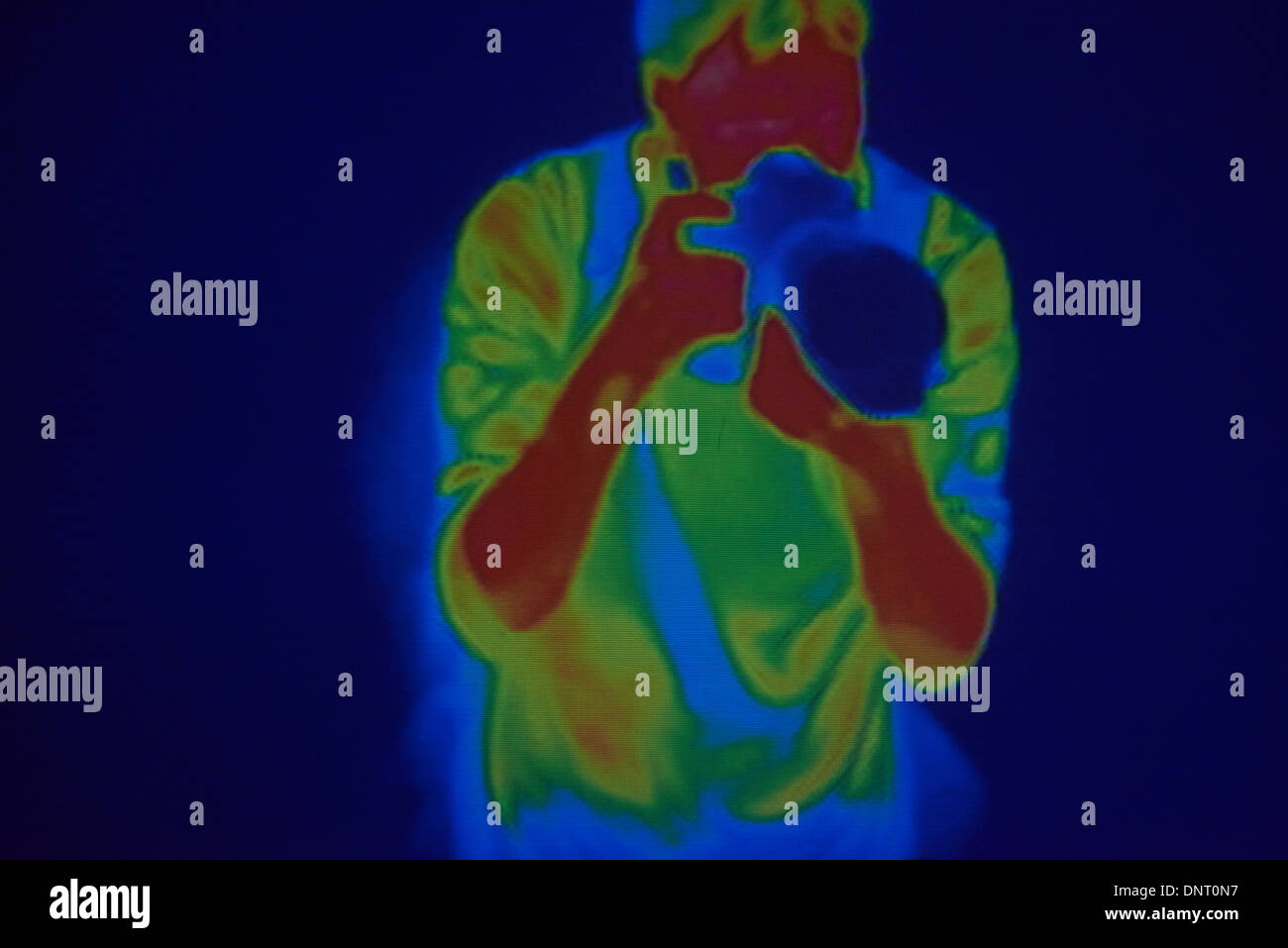 Thermogram hi-res stock photography and images - Alamy