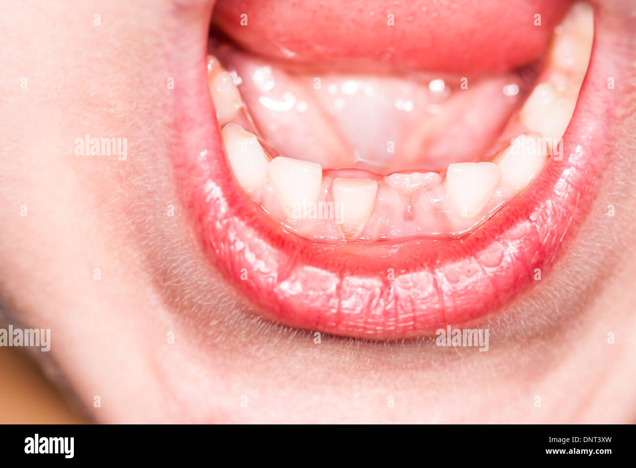 Baby with cute smile showing her first two front teeth hi-res stock ...