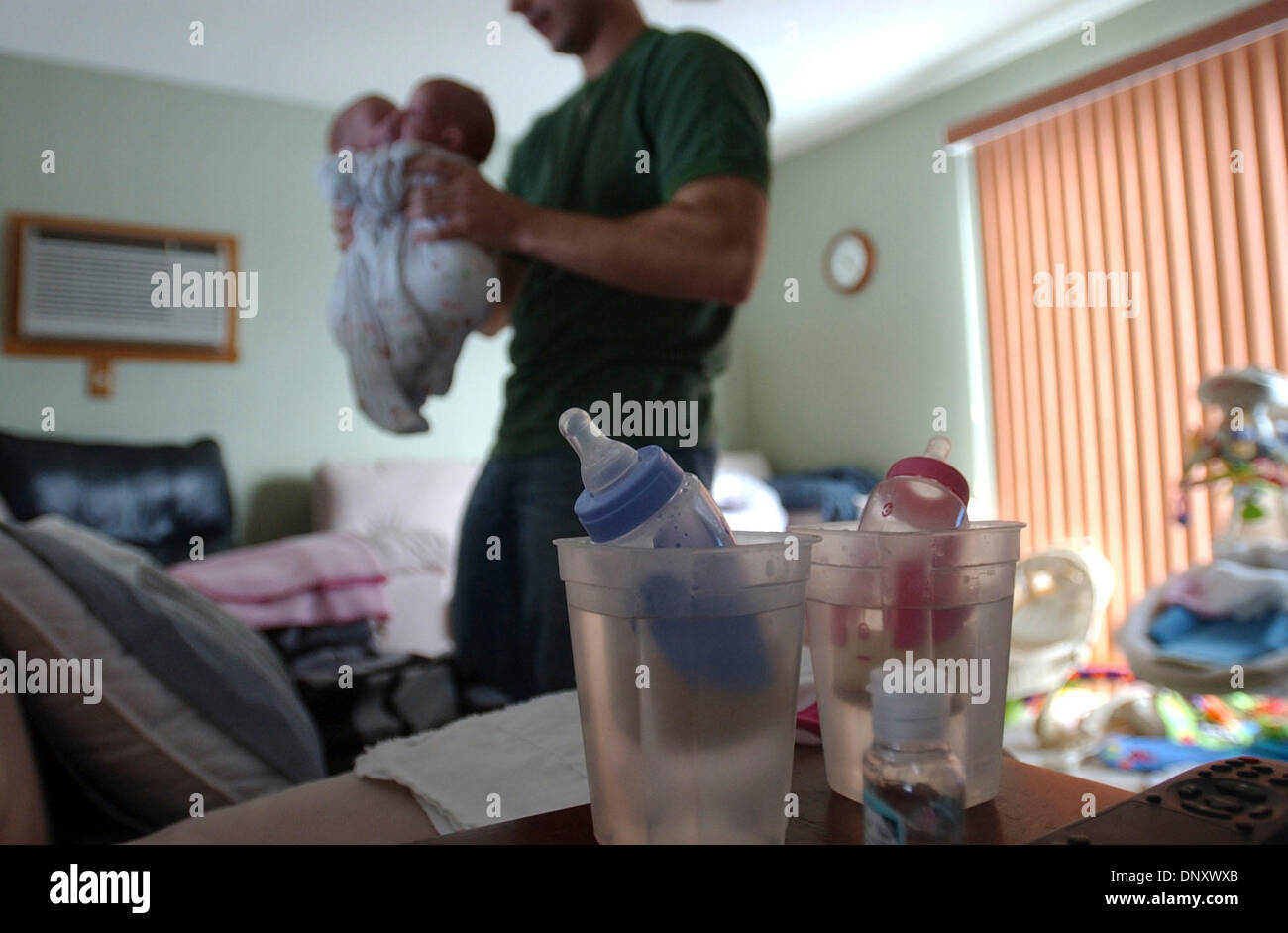 Conjoined Twins Separated High Resolution Stock Photography and Images ...