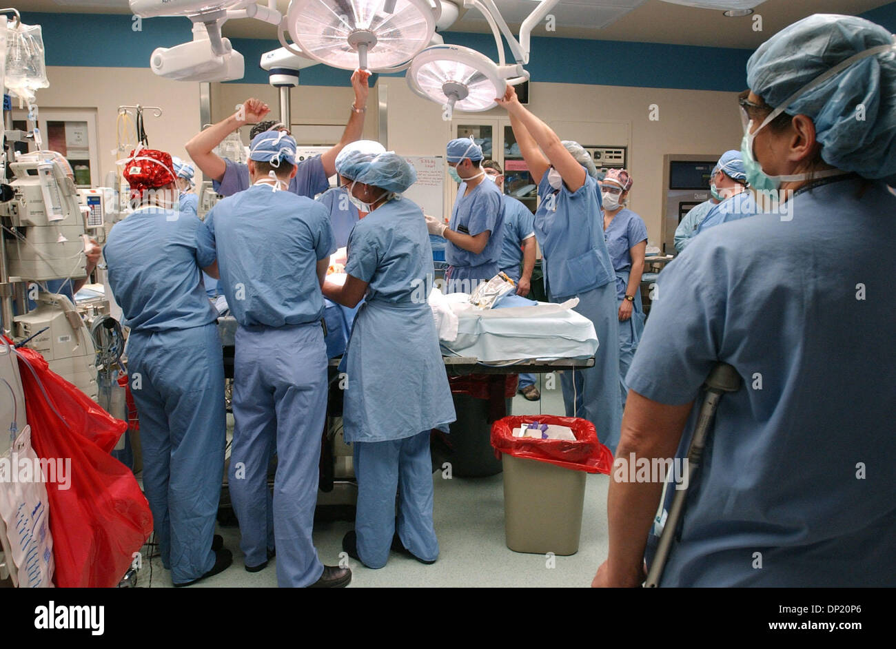 May 12, 2006; Rochester, MN, USA; A surgical team works on separating ...