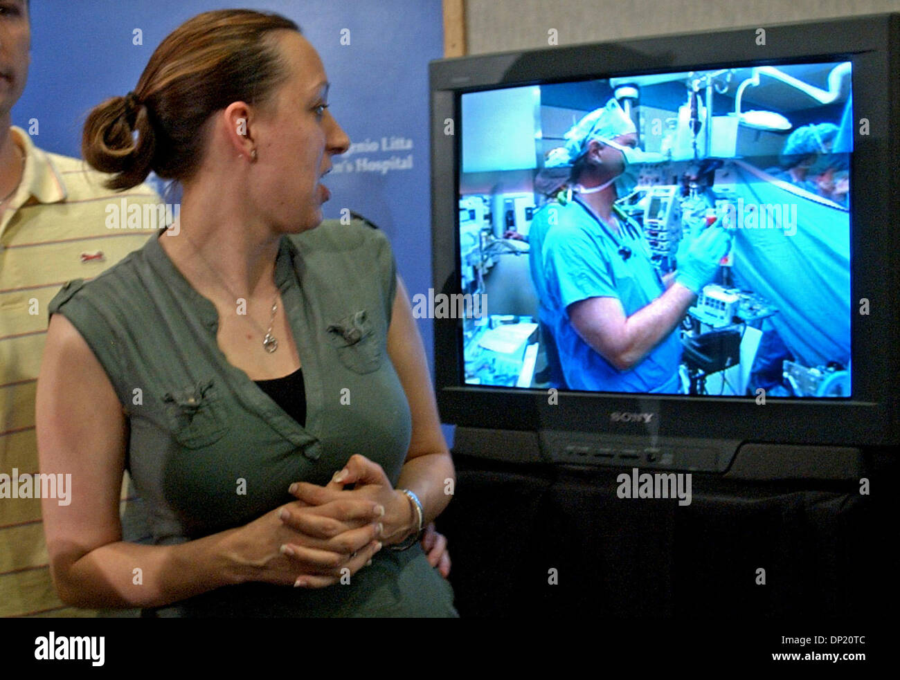 Conjoined twins separated hi-res stock photography and images - Alamy