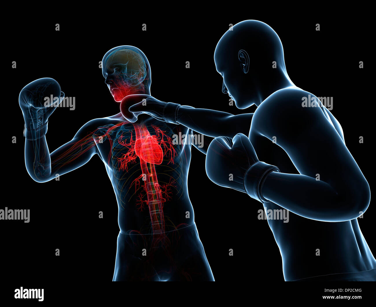 Boxing match, artwork Stock Photo - Alamy