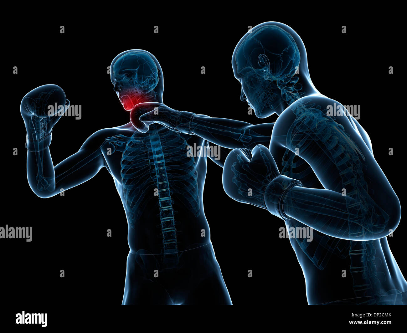 Boxing match, artwork Stock Photo - Alamy