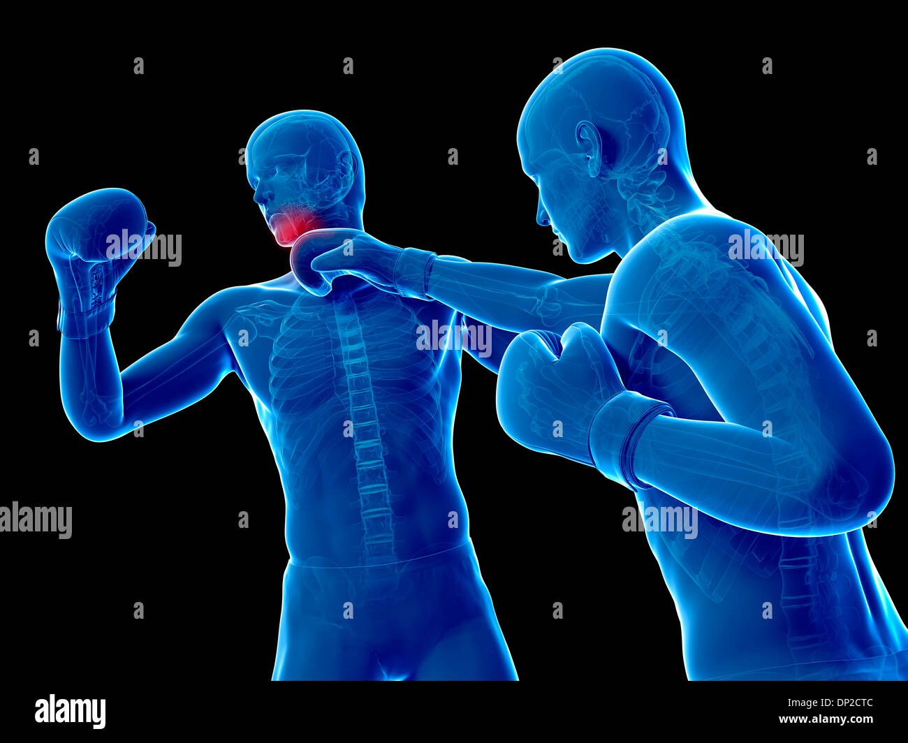 Boxing match, artwork Stock Photo - Alamy