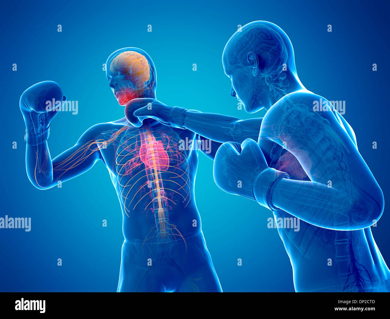Boxing brain hi-res stock photography and images - Alamy