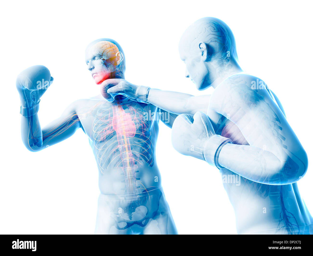 Boxing match, artwork Stock Photo - Alamy