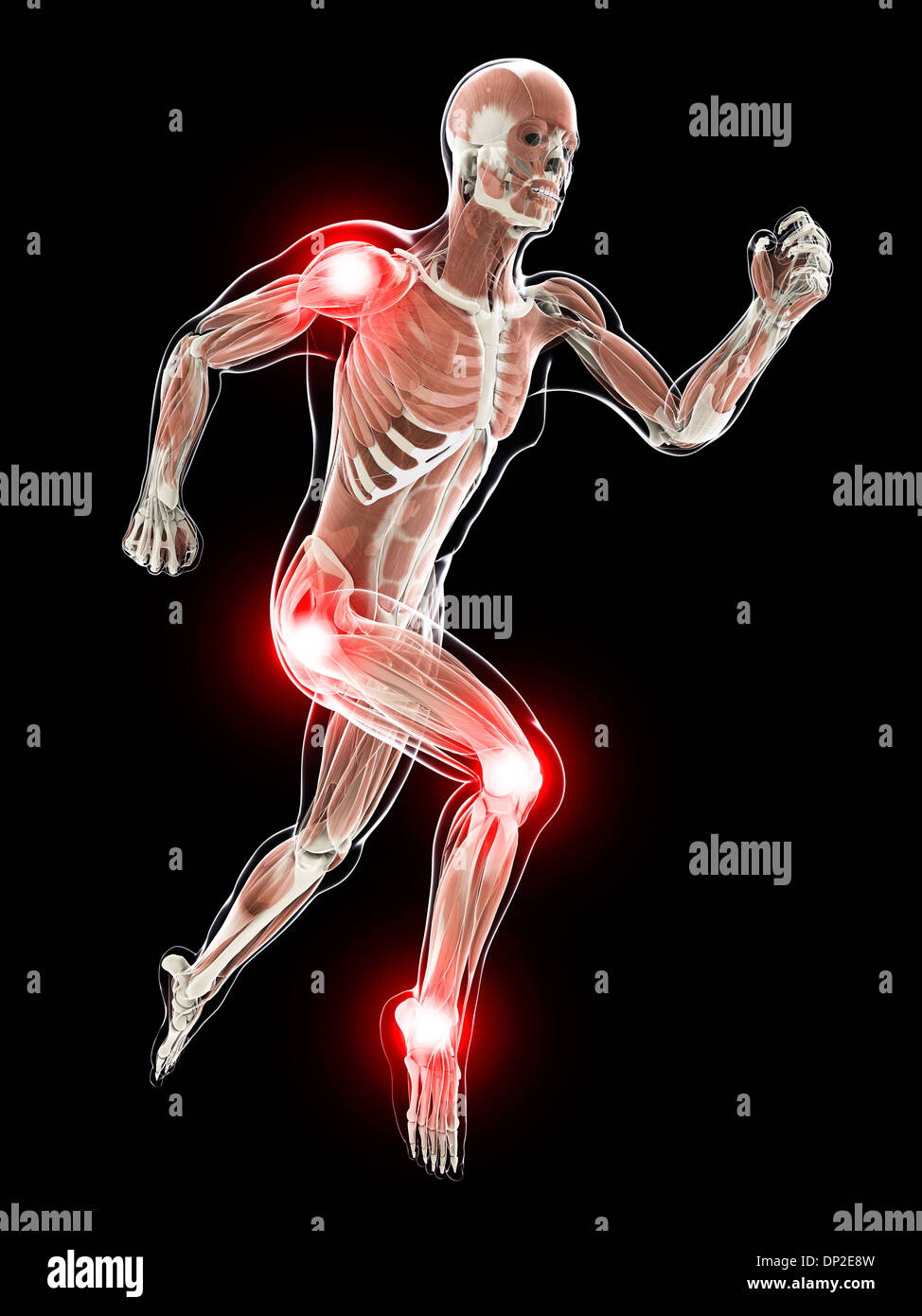 Painful joints, artwork Stock Photo - Alamy