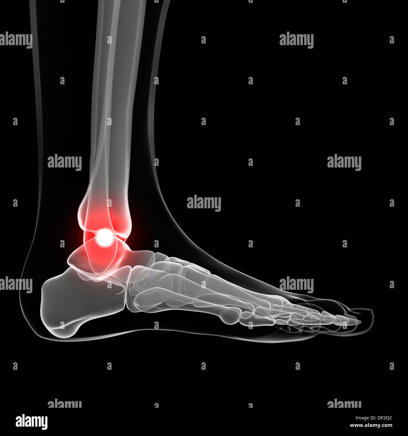 Painful ankle, artwork Stock Photo - Alamy