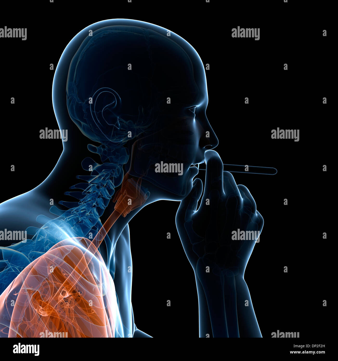 Human Lung Smoker High Resolution Stock Photography and Images - Alamy