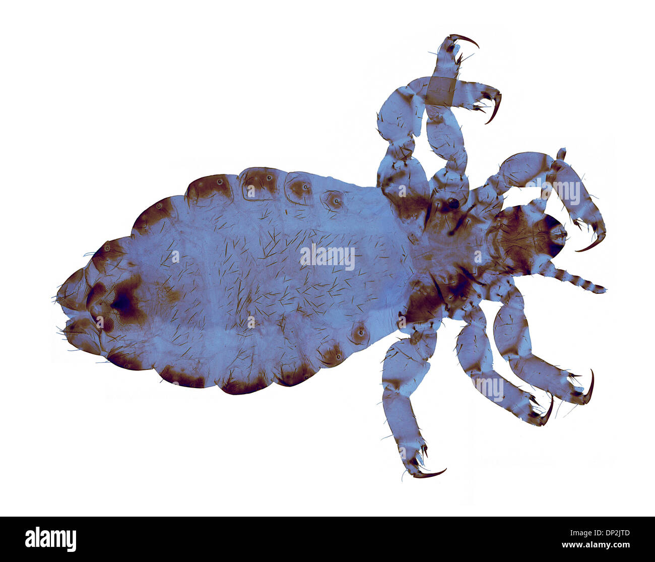 Head louse, light micrograph Stock Photo - Alamy