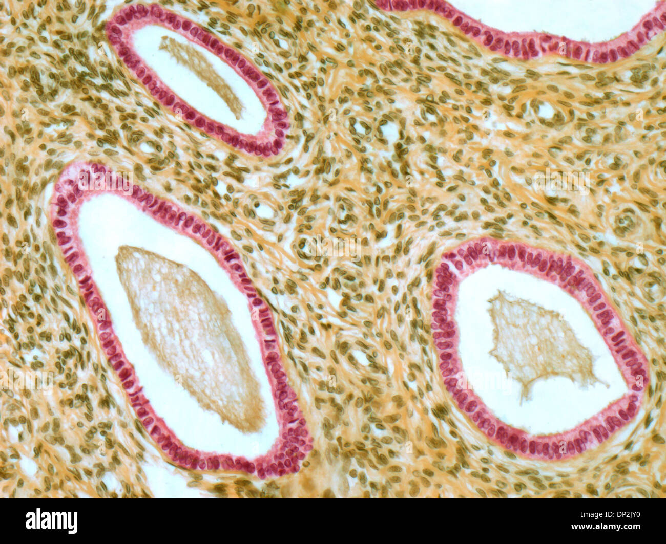 Cervix hi-res stock photography and images - Alamy