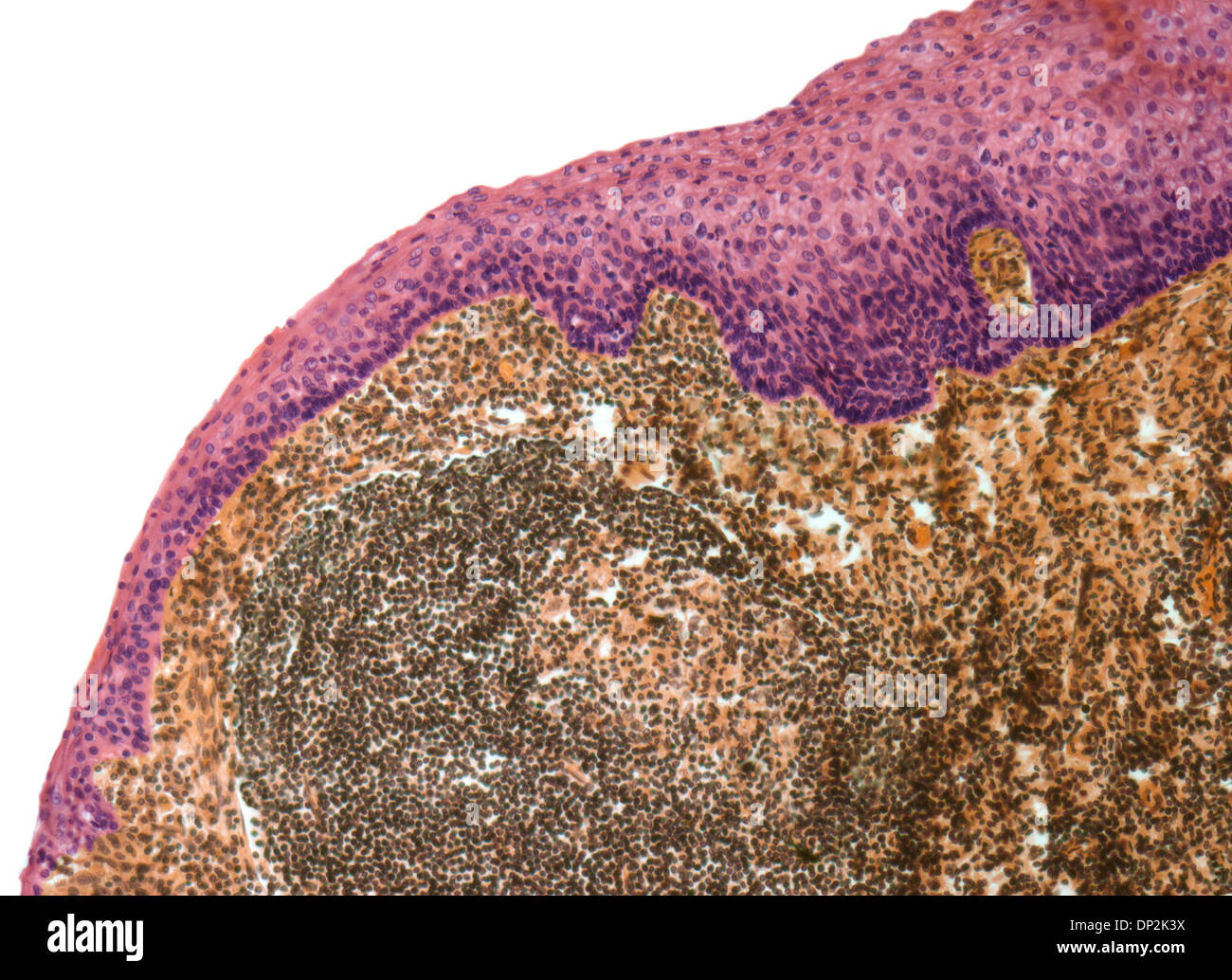 Tonsil, light micrograph Stock Photo - Alamy