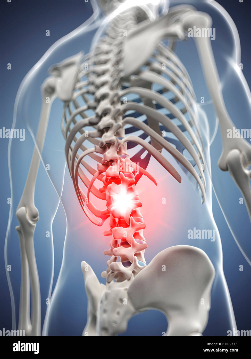 Back pain, artwork Stock Photo - Alamy
