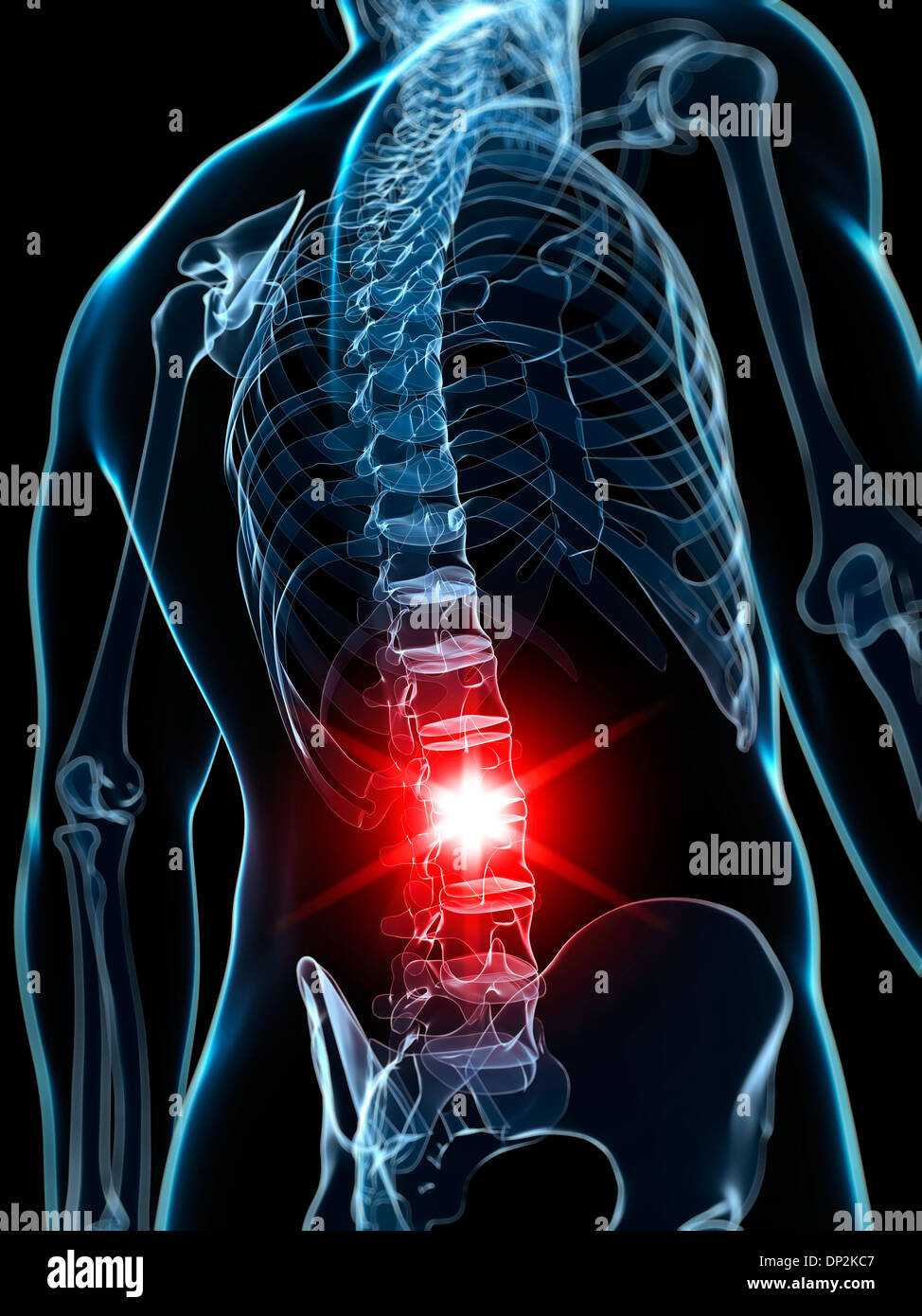 Pain mid back illustration hi-res stock photography and images - Alamy