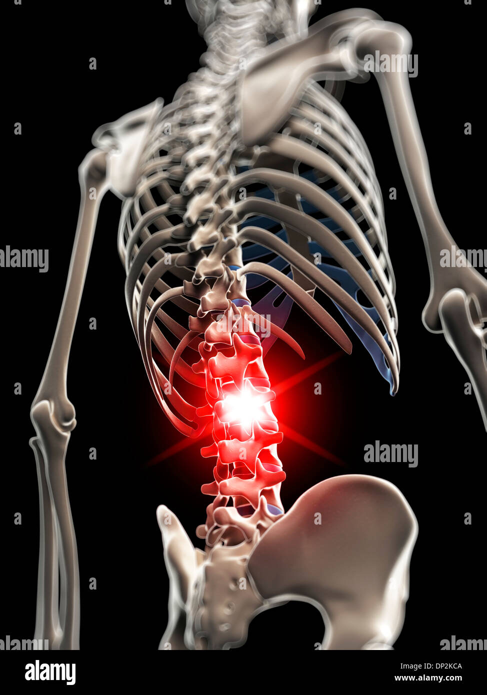 Back pain, artwork Stock Photo - Alamy