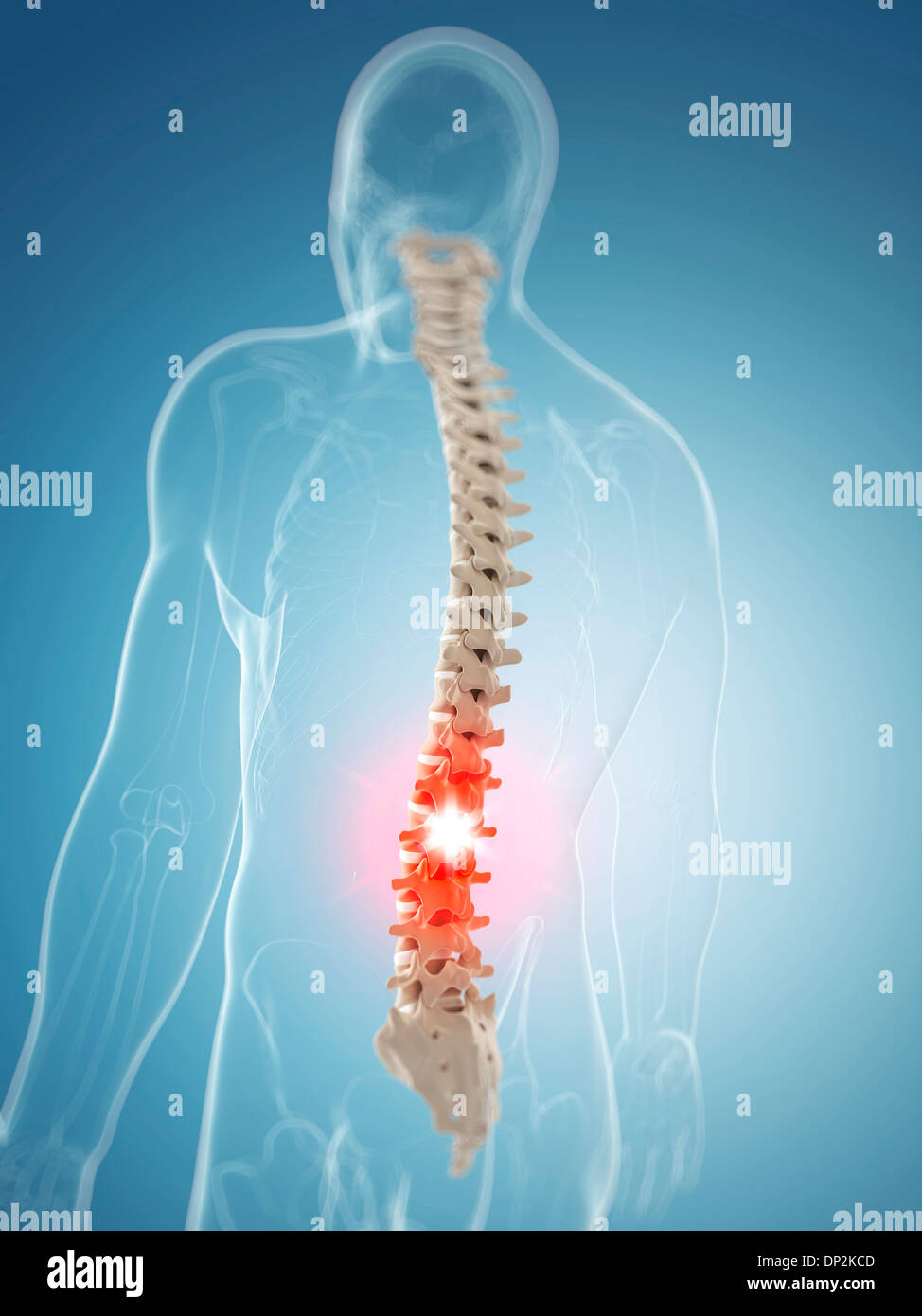 Back pain, artwork Stock Photo - Alamy