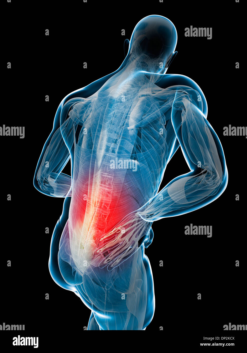 Back pain, artwork Stock Photo - Alamy