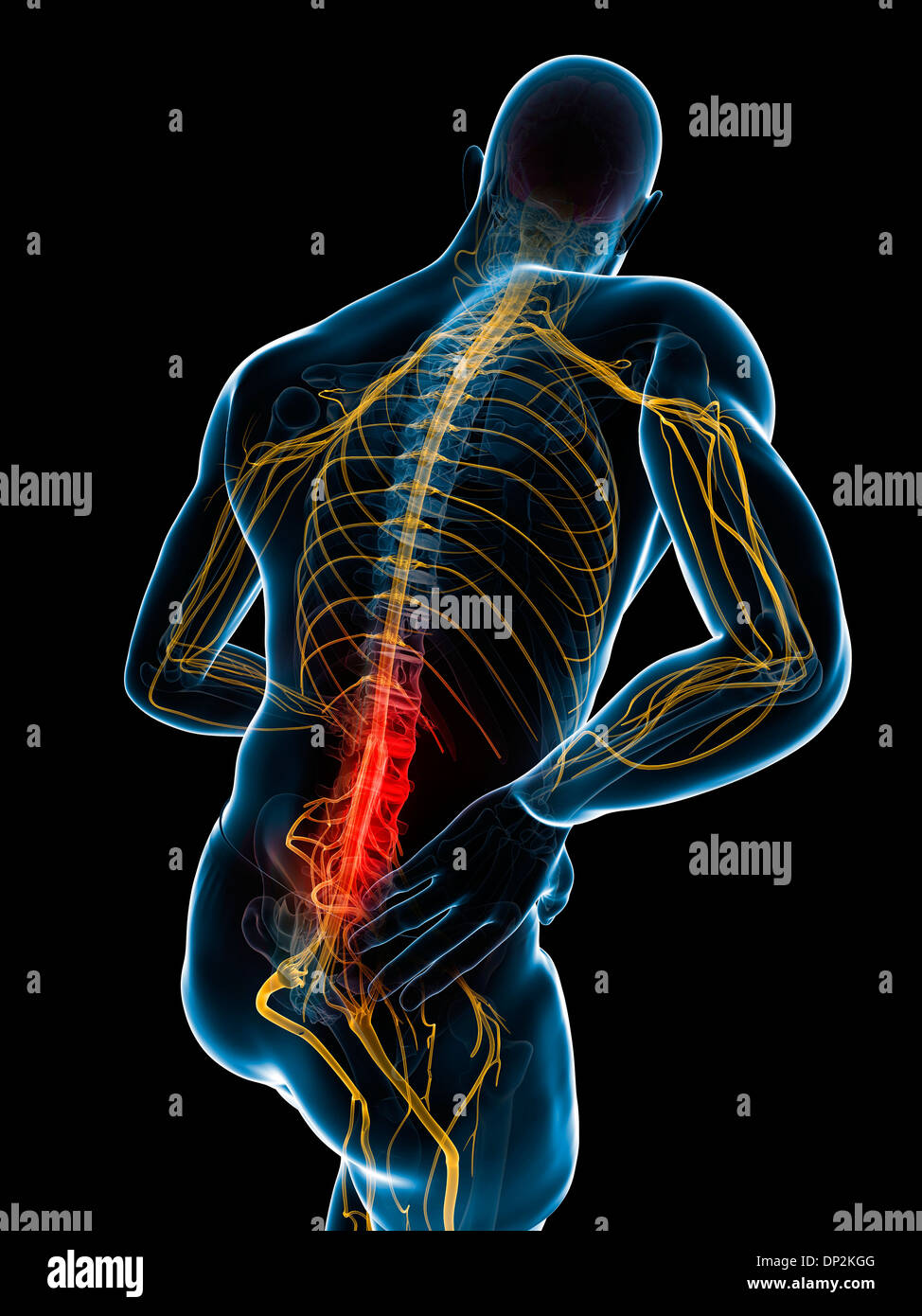Back pain, artwork Stock Photo - Alamy