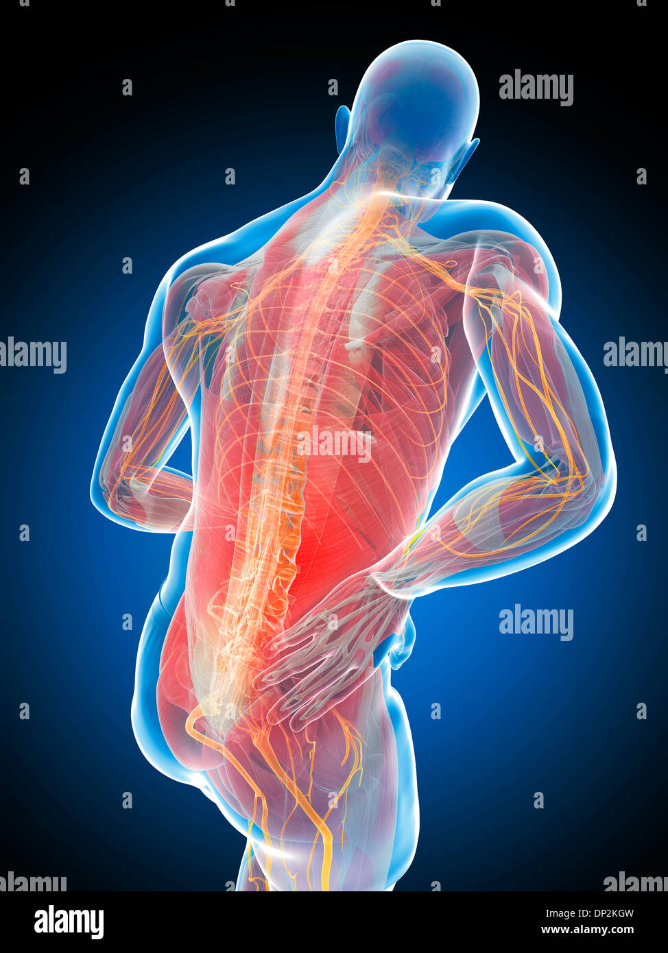 Back pain, artwork Stock Photo - Alamy