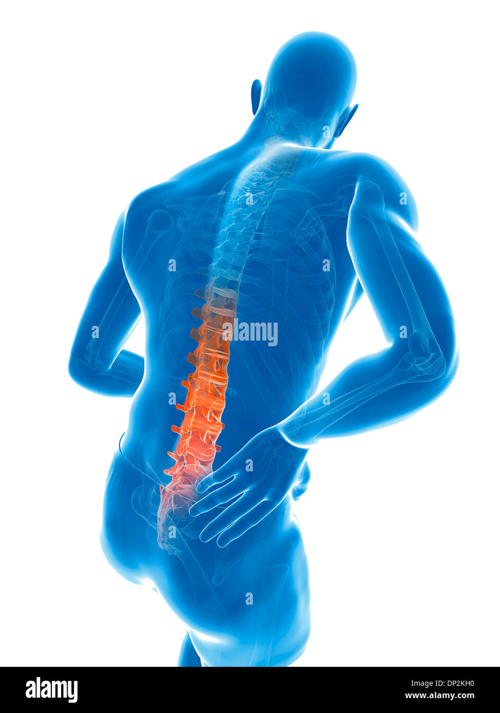 Back pain, artwork Stock Photo - Alamy