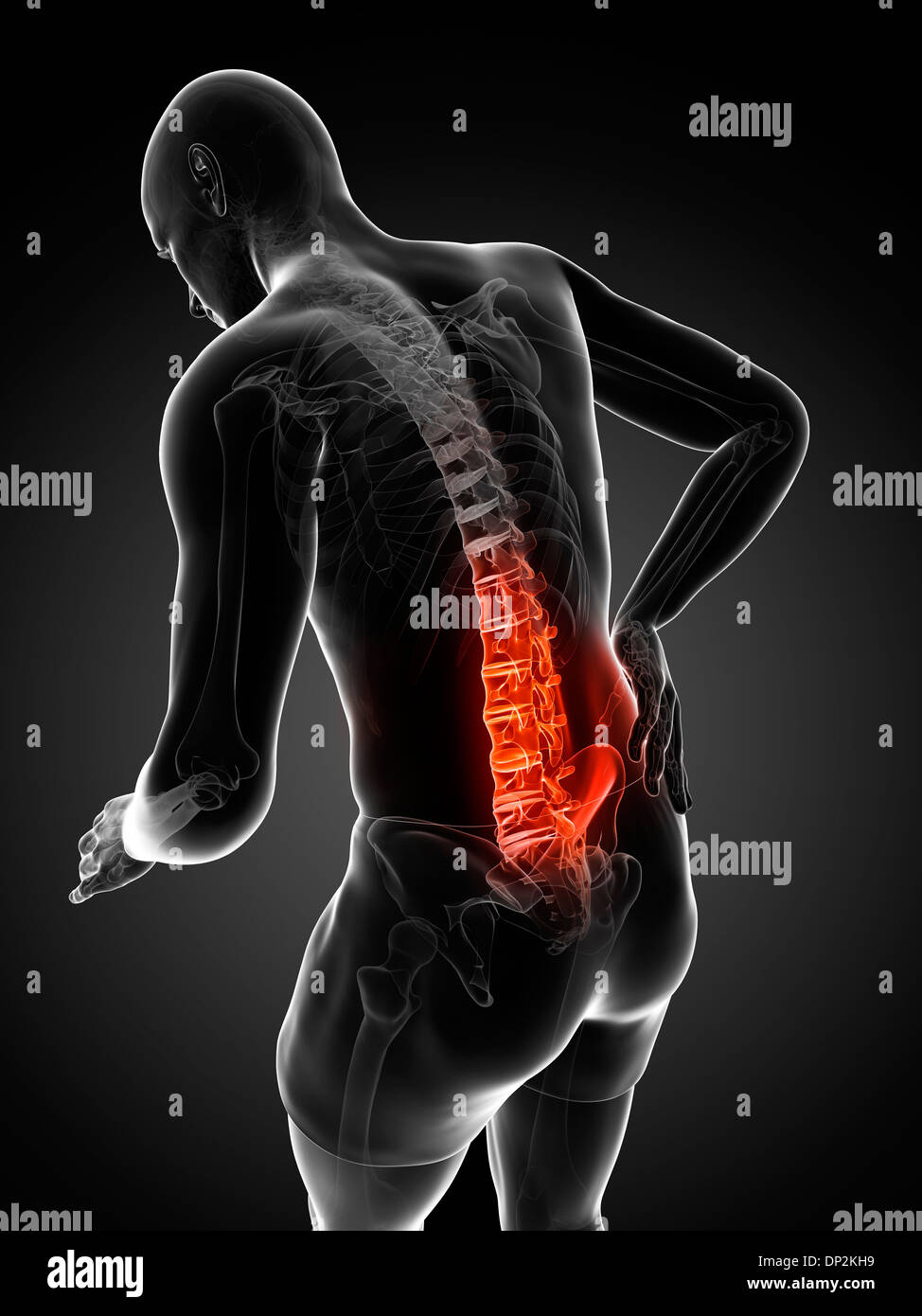 Back pain, artwork Stock Photo - Alamy