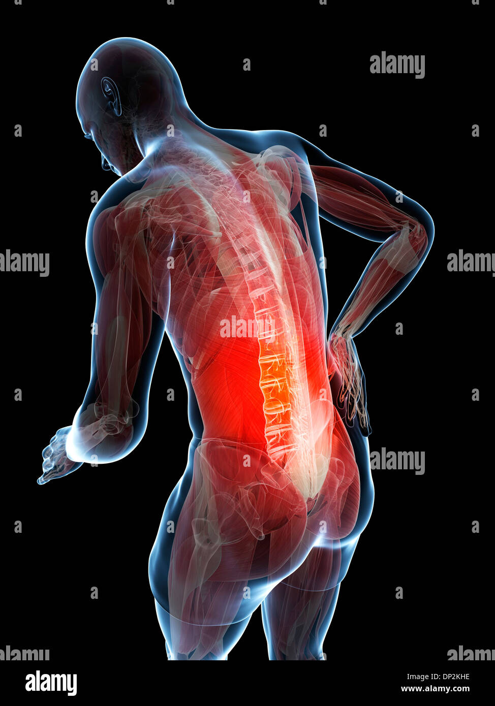 Back pain, artwork Stock Photo - Alamy