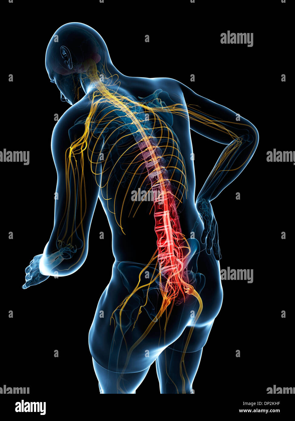 Back pain, artwork Stock Photo - Alamy