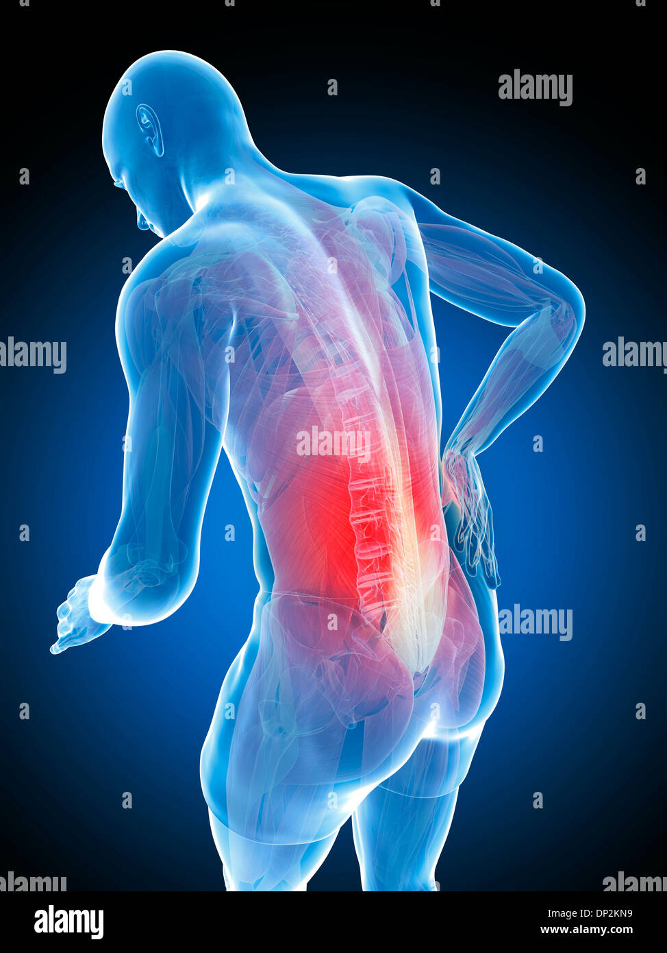 Back pain, artwork Stock Photo - Alamy
