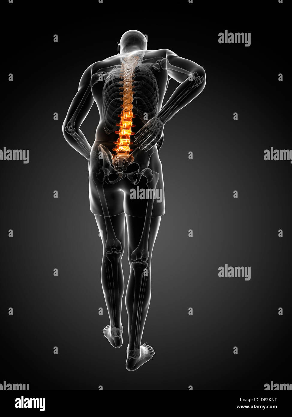 Back pain, artwork Stock Photo - Alamy