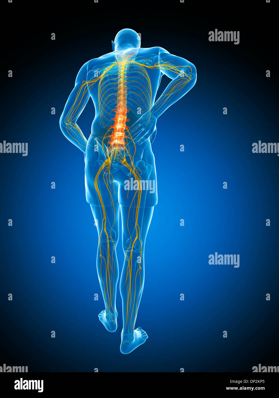 Back pain, artwork Stock Photo - Alamy